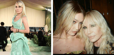 Donatella Versace Before and After Plastic Surgery Journey