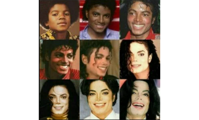 Michael Jackson Plastic Surgery Before and After