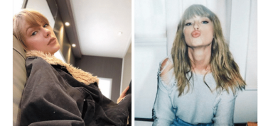 Taylor Swift Before and After Plastic Surgery Journey