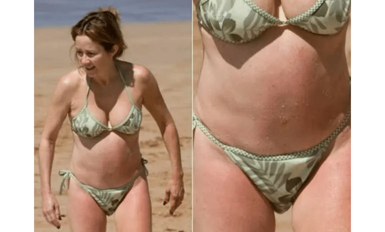 Patricia Heaton From Tummy Tuck To Breast Augmentation
